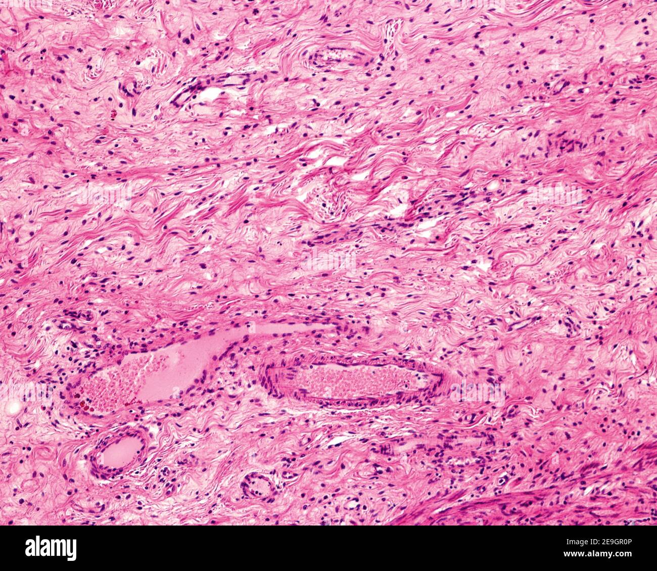 Example of a typical loose connective tissue belonging to the submucosa ...