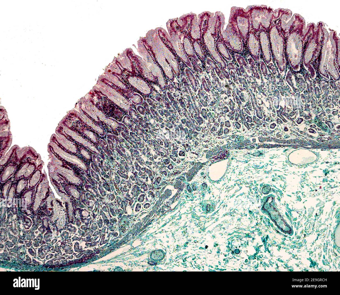 Gastric mucosa stained showing: surface epithelium, gastric pits with ...