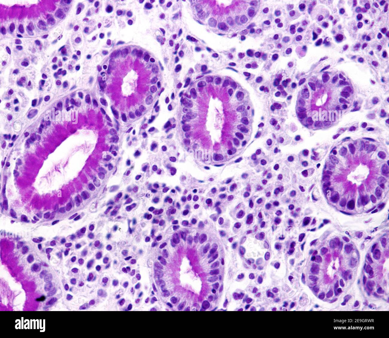 Cross section of gastric pits lined by the surface epithelium of a ...
