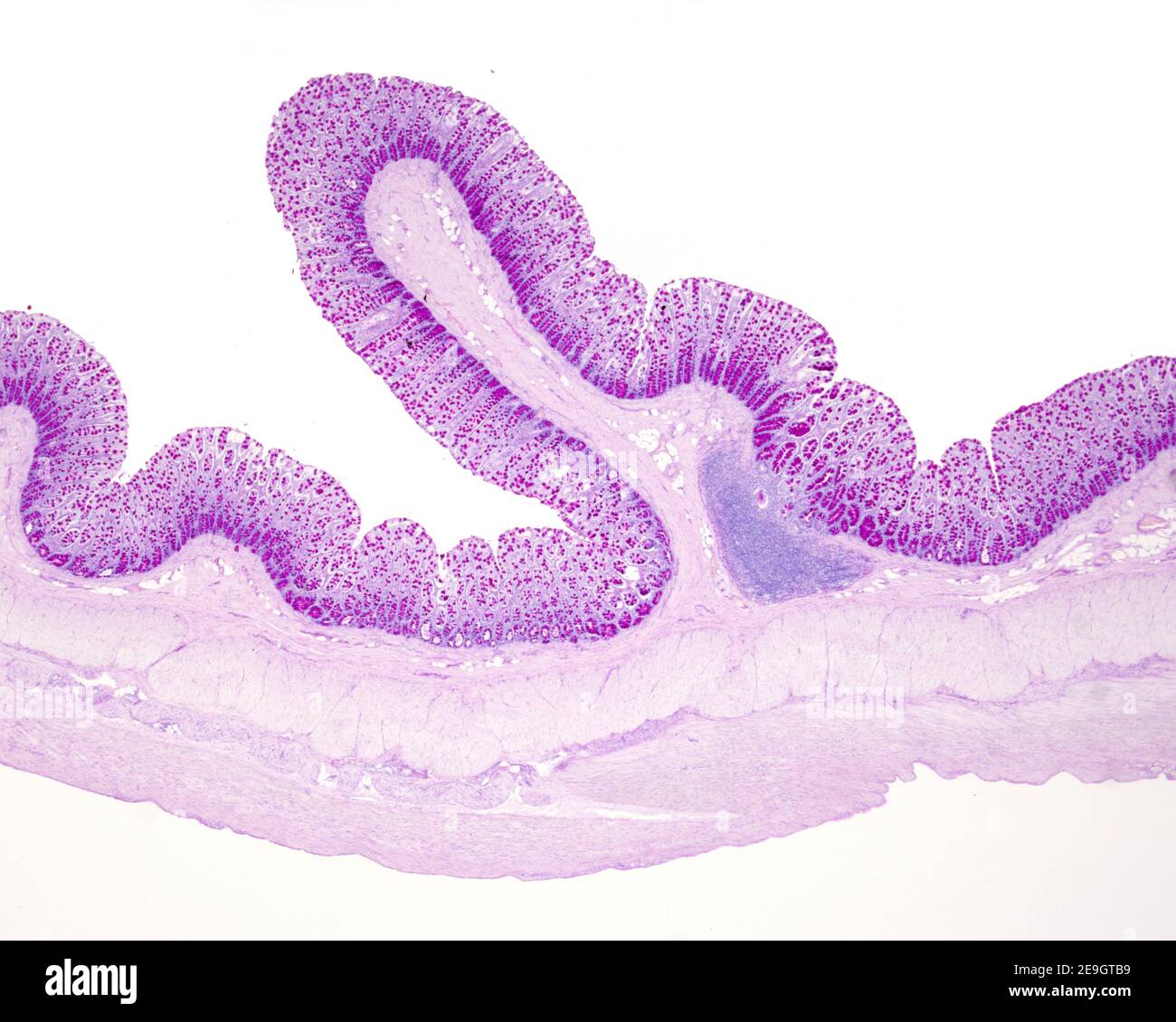 Large intestine mucosa and submucosa hi-res stock photography and ...