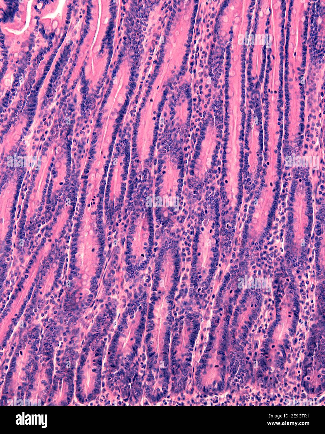 Longitudinal section of Lieberkühn crypts of the small intestine ...