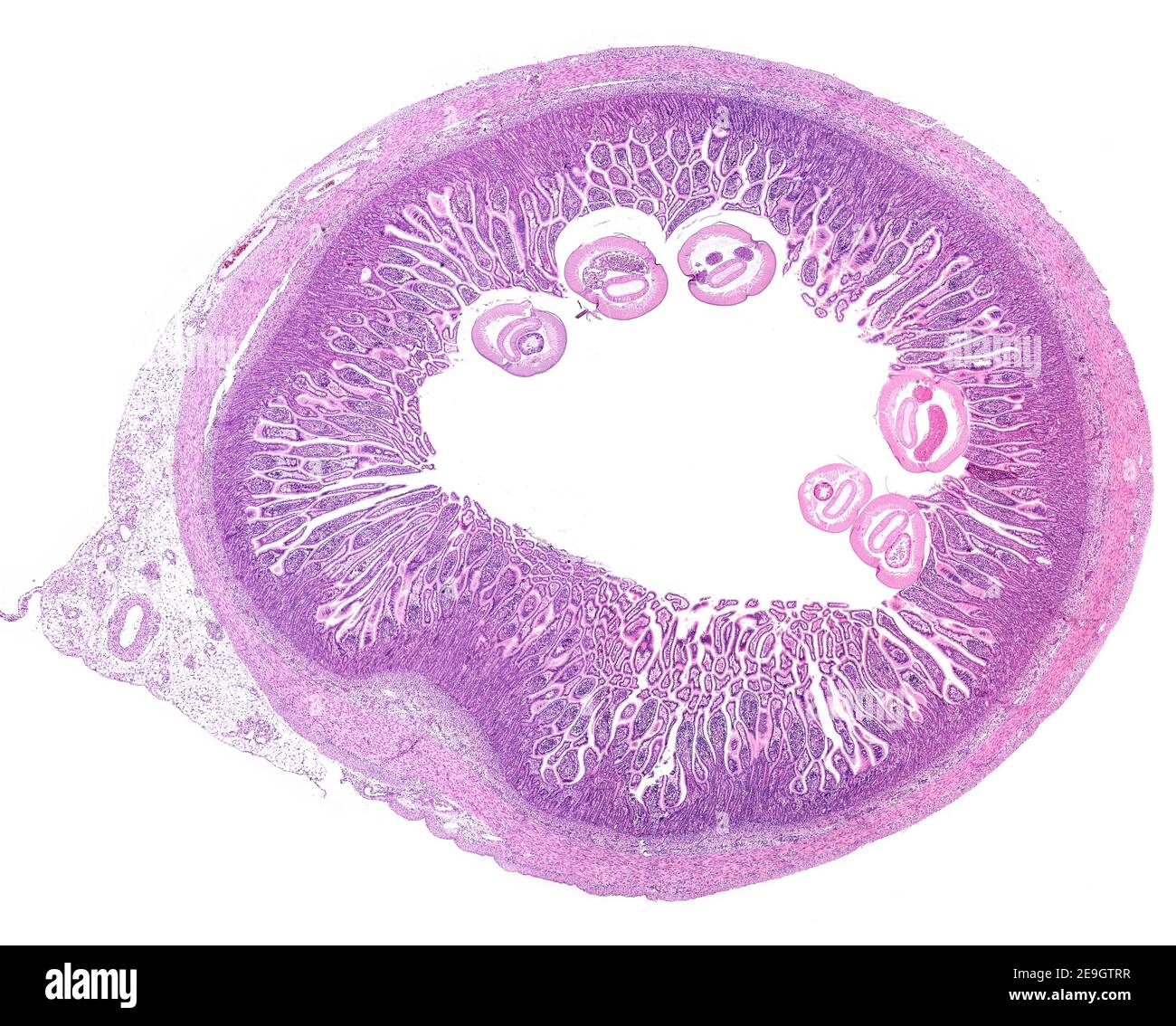 Enterobius Vermicularis Ova