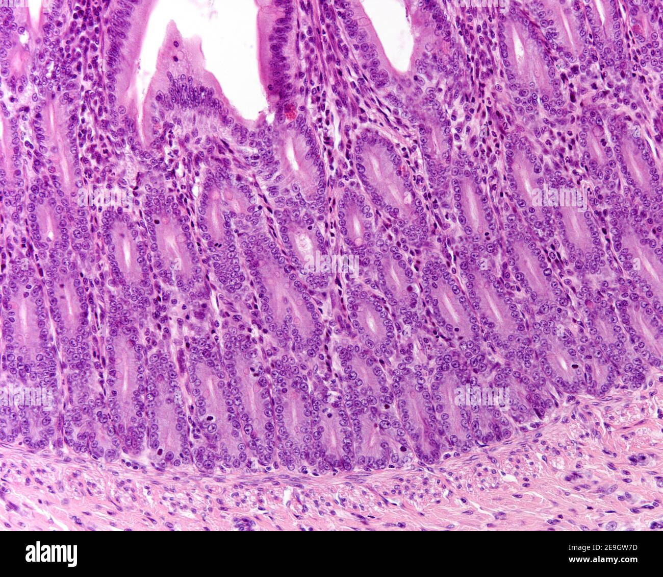 Bottom of the Lieberkühn crypts of a small intestine showing numerous ...