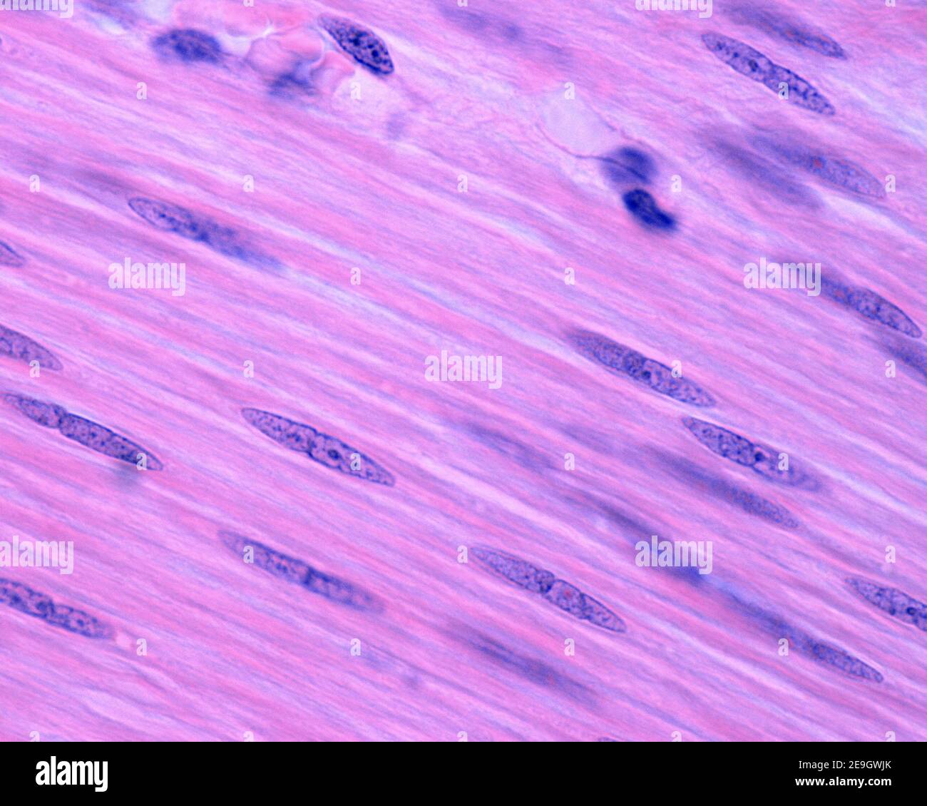 Smooth Muscle Cell Under Microscope