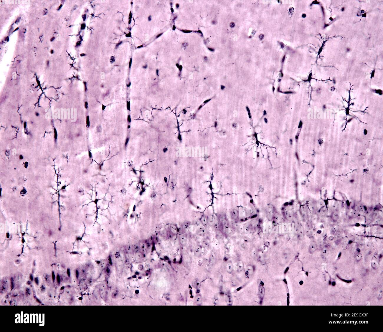 High magnification micrograph showing microglia cells of the CA1 region ...