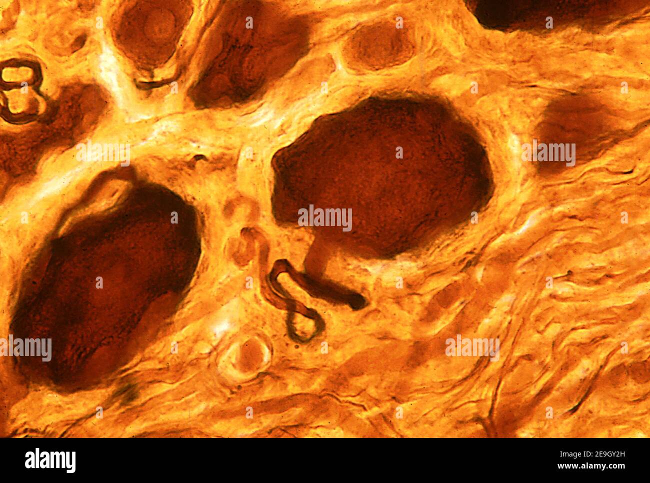 Pseudounipolar neuron hi-res stock photography and images - Alamy