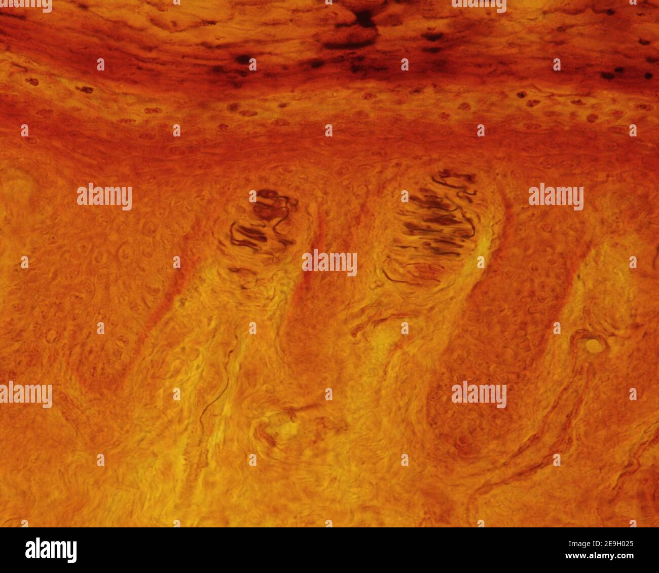 Silver impregnated Meissner corpuscles located in the dermal papillae ...