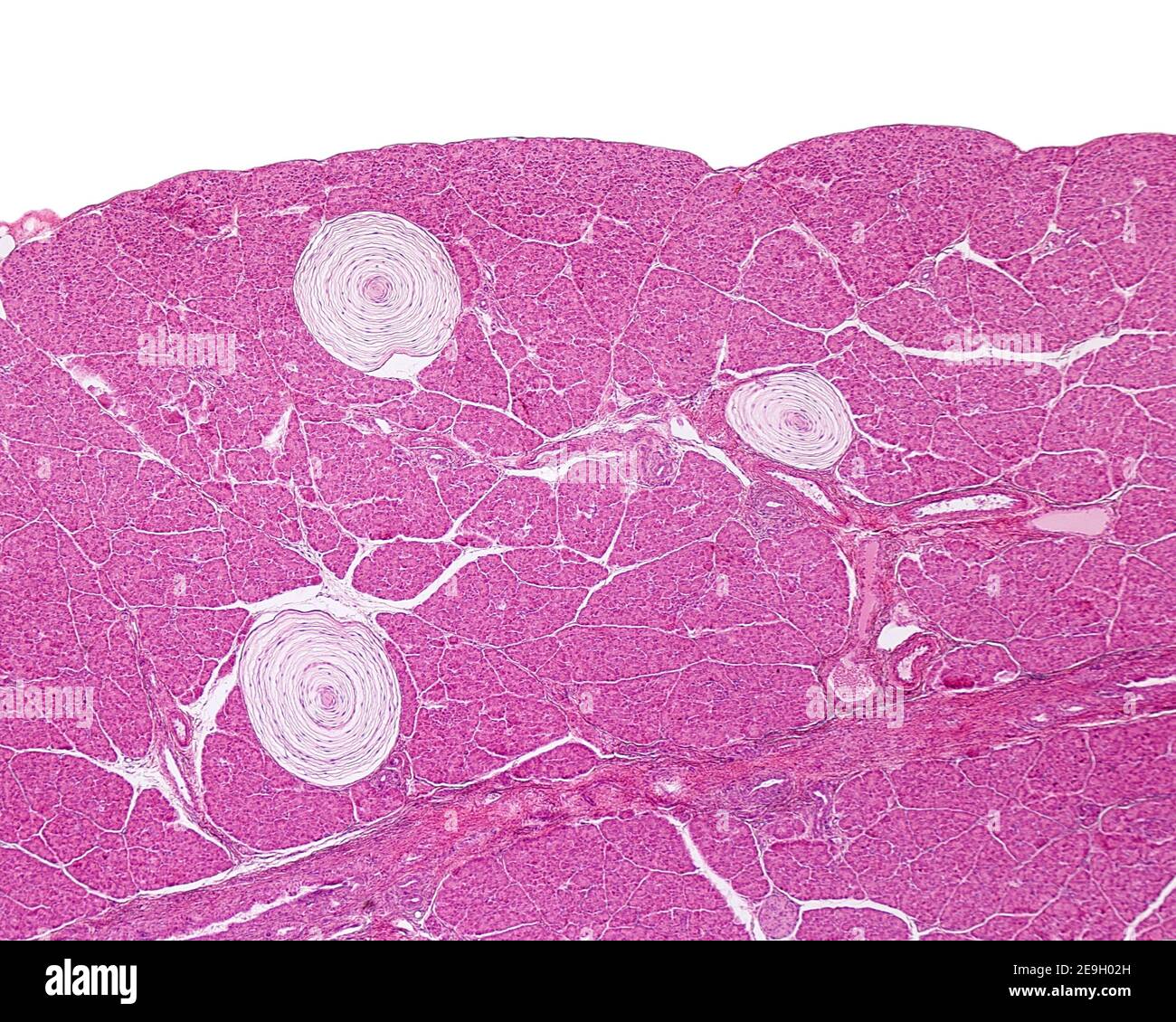 Ruffini Corpuscles Histology