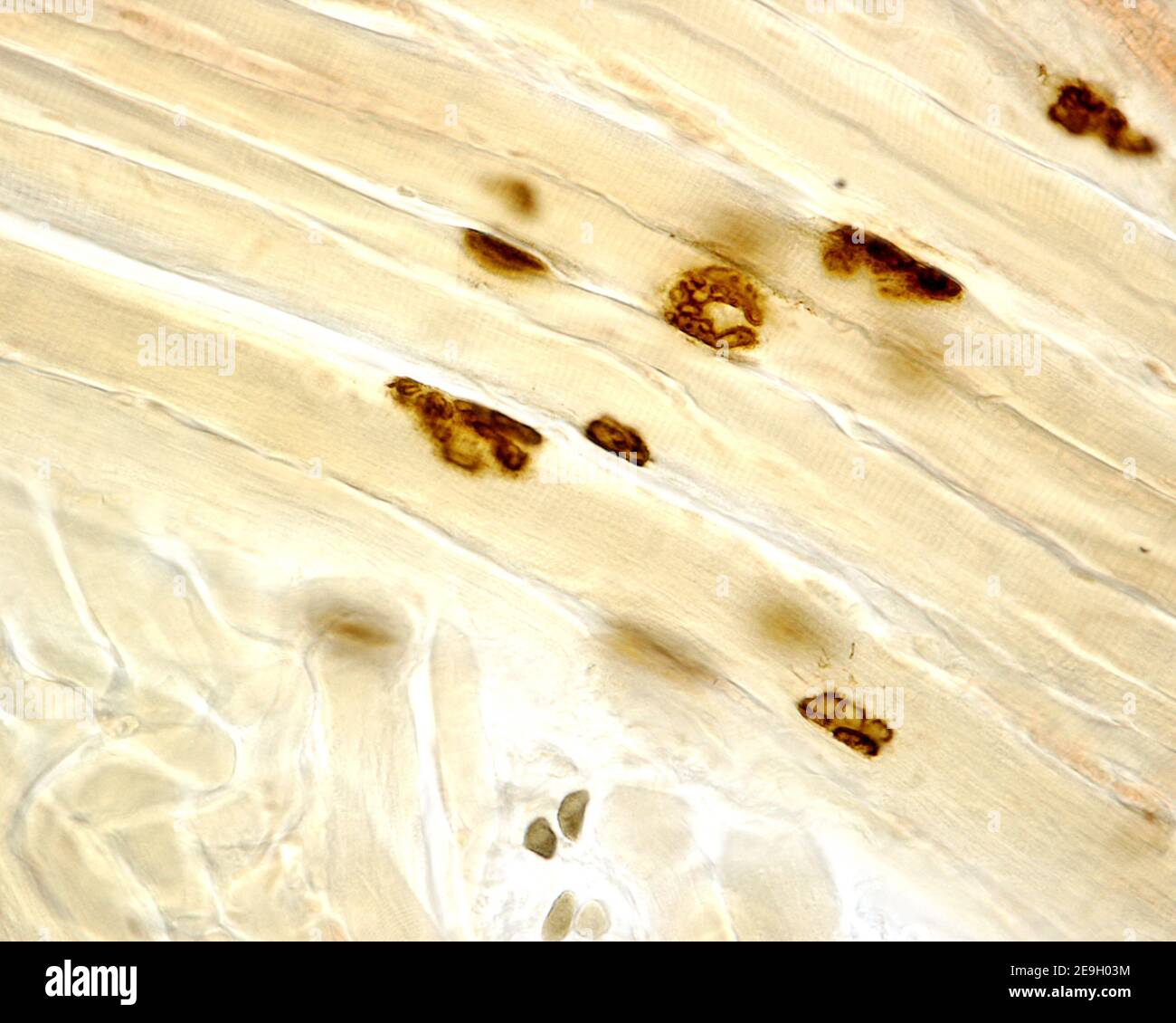 Motor nerve cell micrograph hi-res stock photography and images - Alamy
