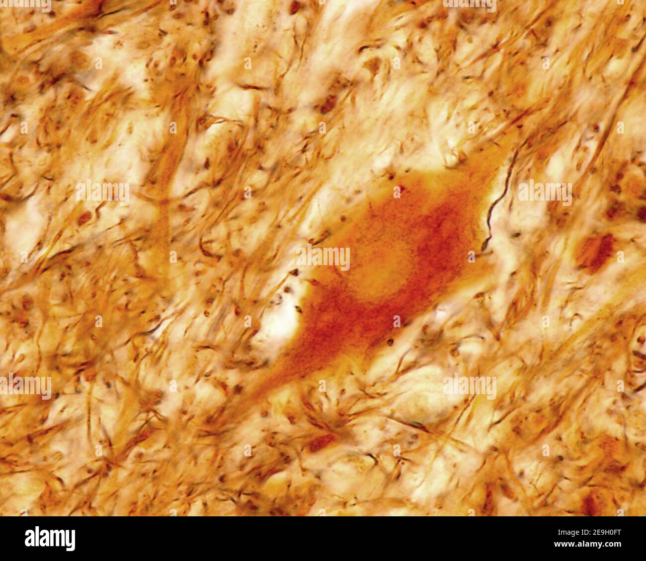 Neuronal cell body showing several synaptic terminals, mainly in the ...