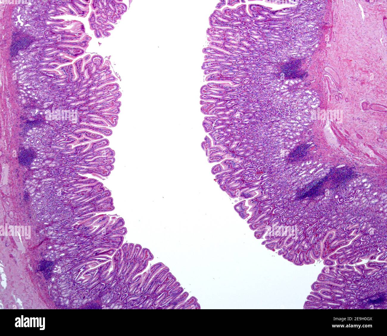 Gastric mucosa. Pyloric antrum showing: the great depth of the gastric ...