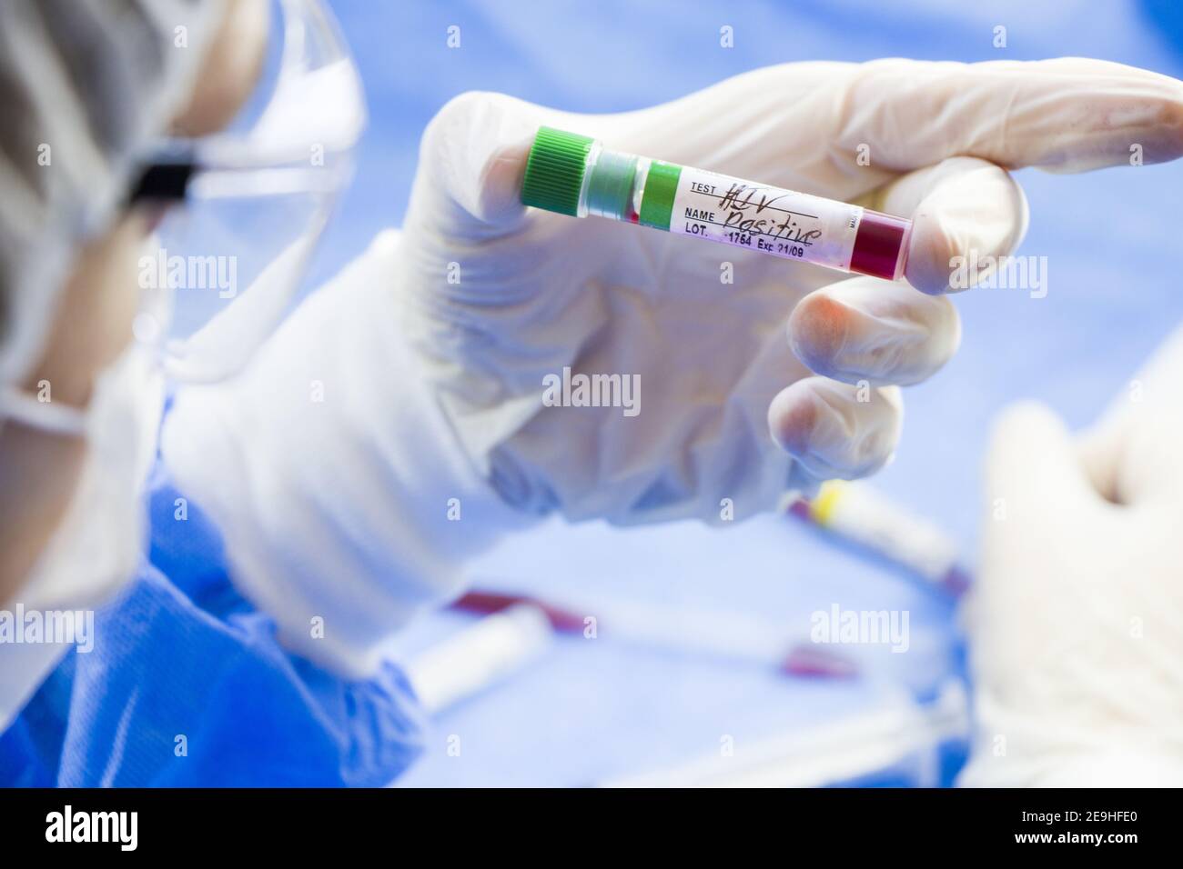 Doctor with a latex glove holding an HIV positive test tube in the ...