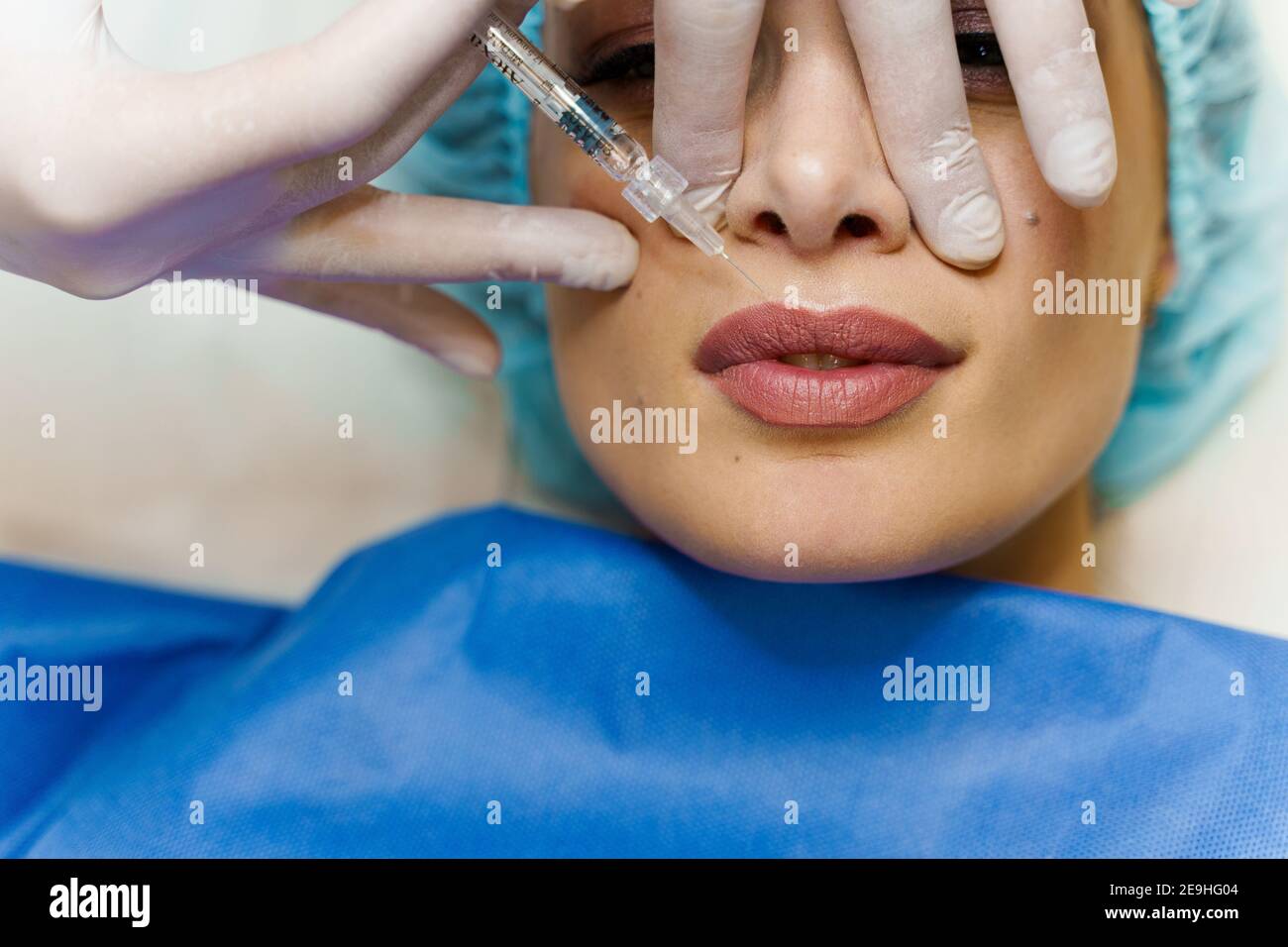 Closeup lips augmentation injections for attractive girl. Plastic ...