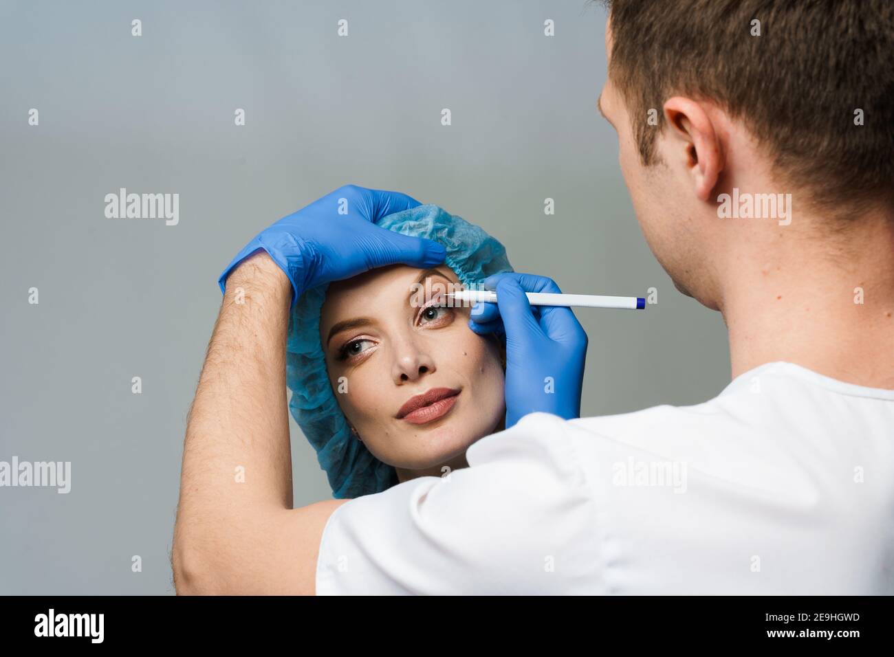 Blepharoplasty markup close-up on the face before the plastic surgery ...