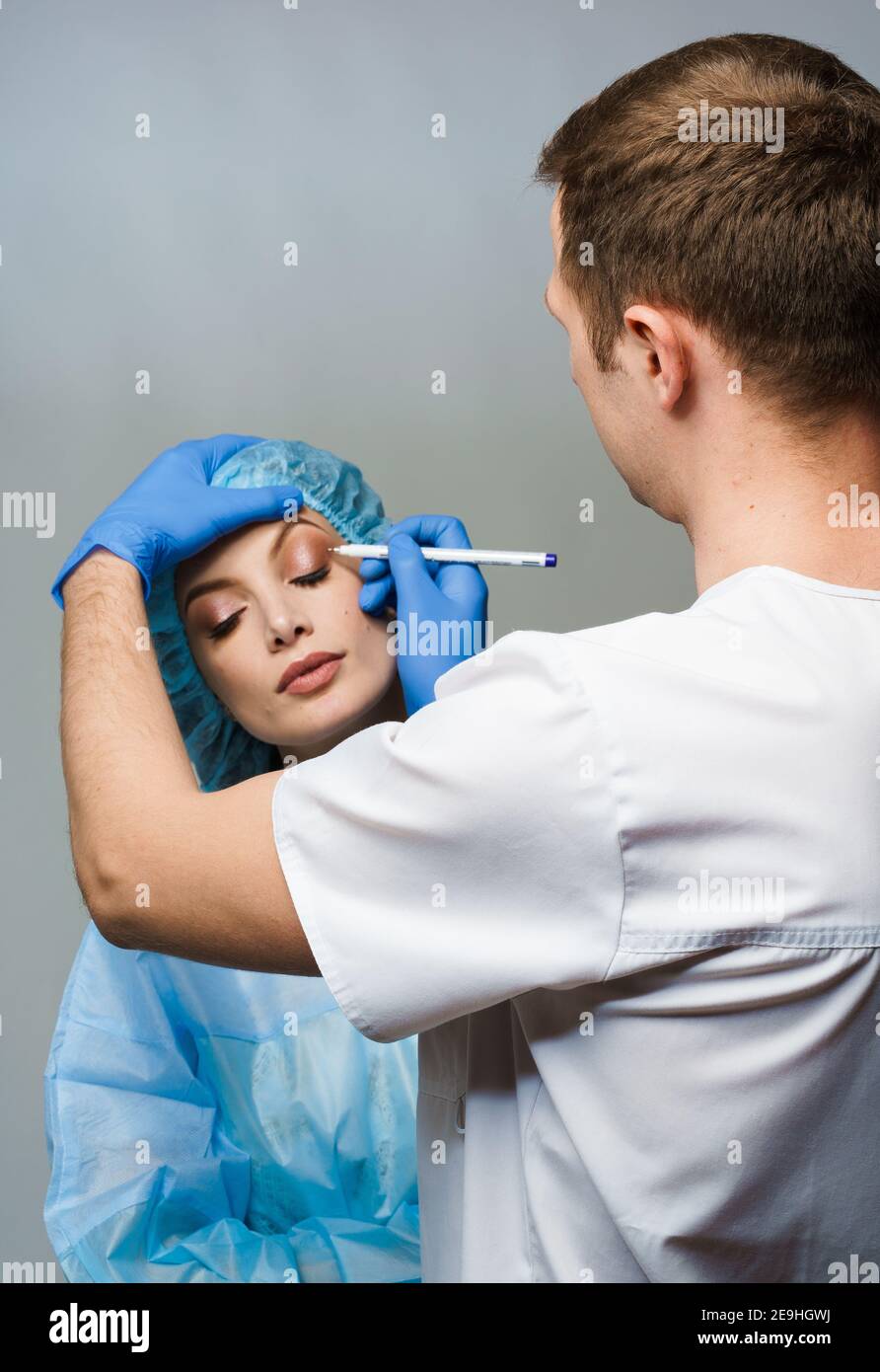 Blepharoplasty markup close-up on the face before the plastic surgery ...