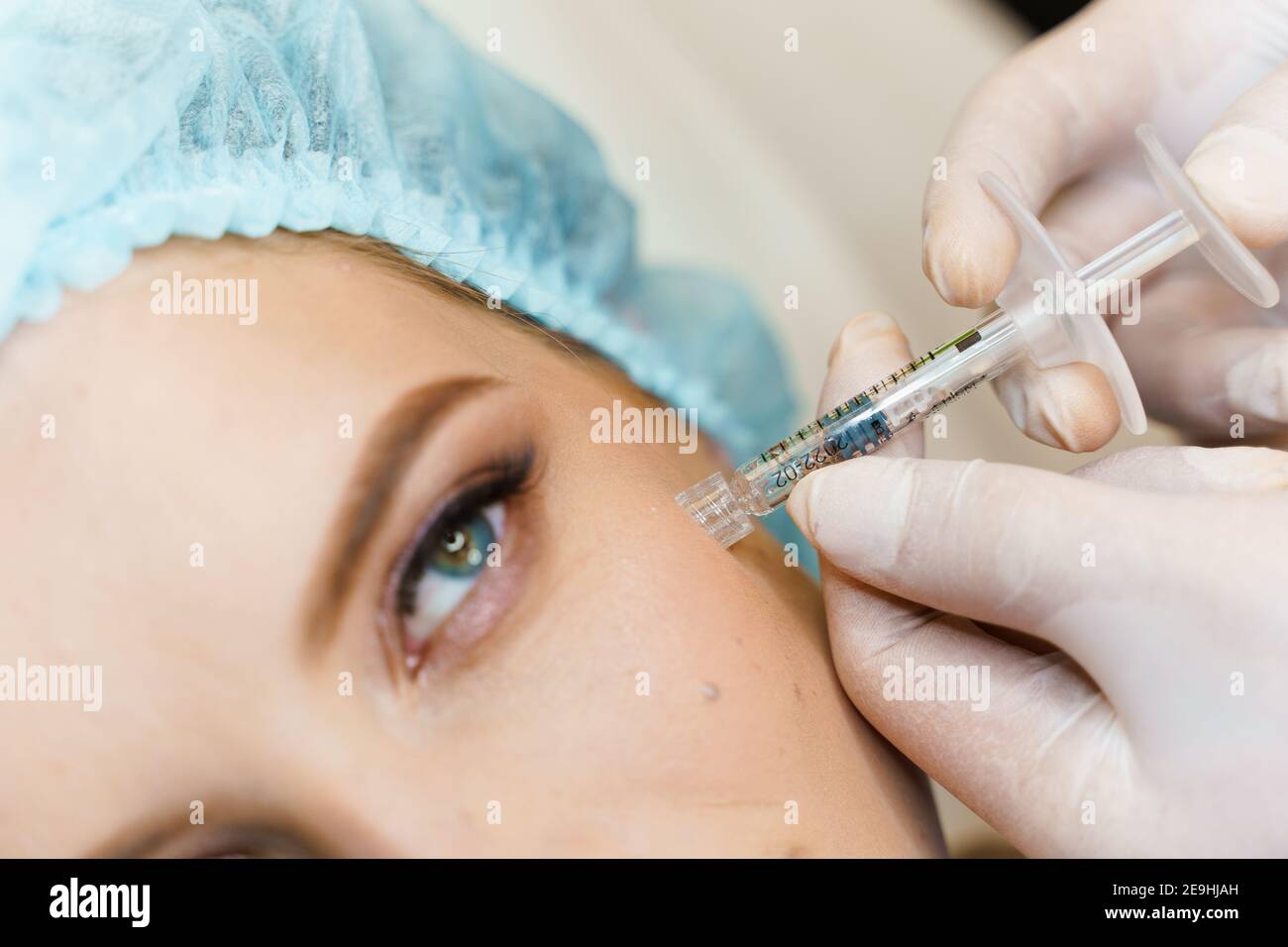 Close-up filler injection in cheekbones. ?ontour plastic for correcting ...