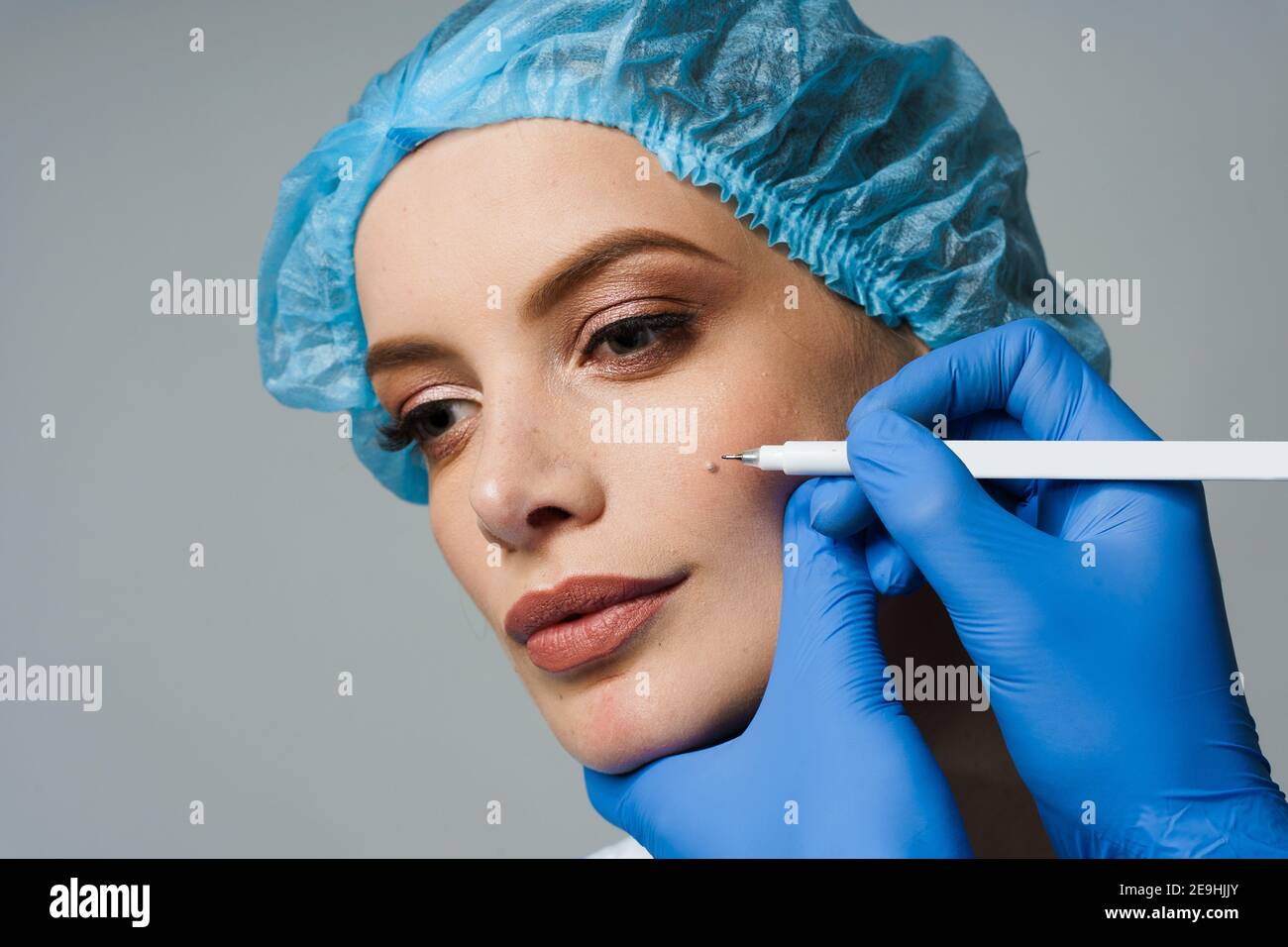 Blepharoplasty markup close-up on the face before the plastic surgery ...