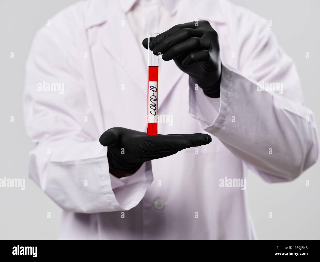 Laboratory Test tube with blood diagnostics research close-up Stock ...