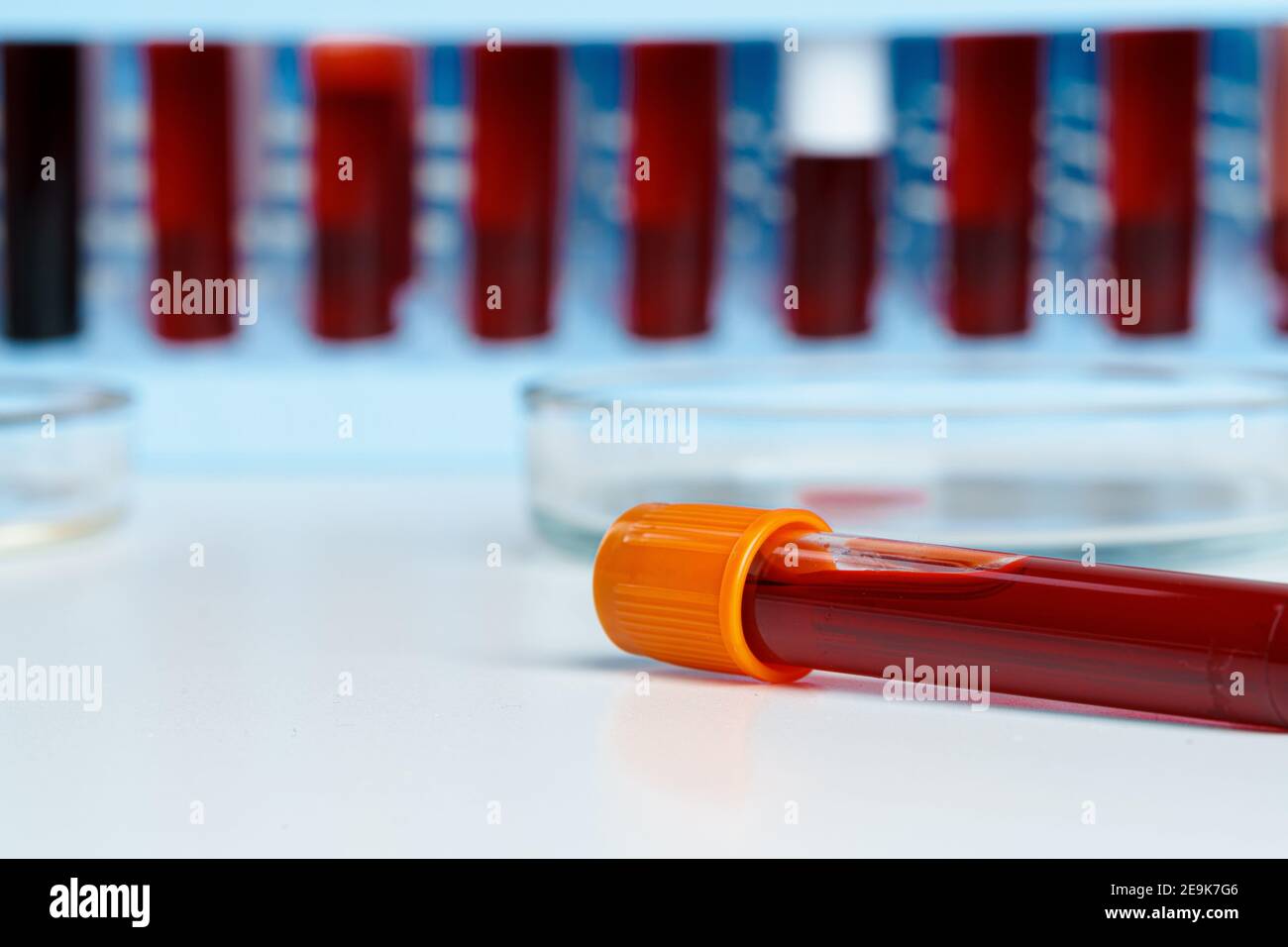 Sample Tubes Flask Container High Resolution Stock Photography and ...