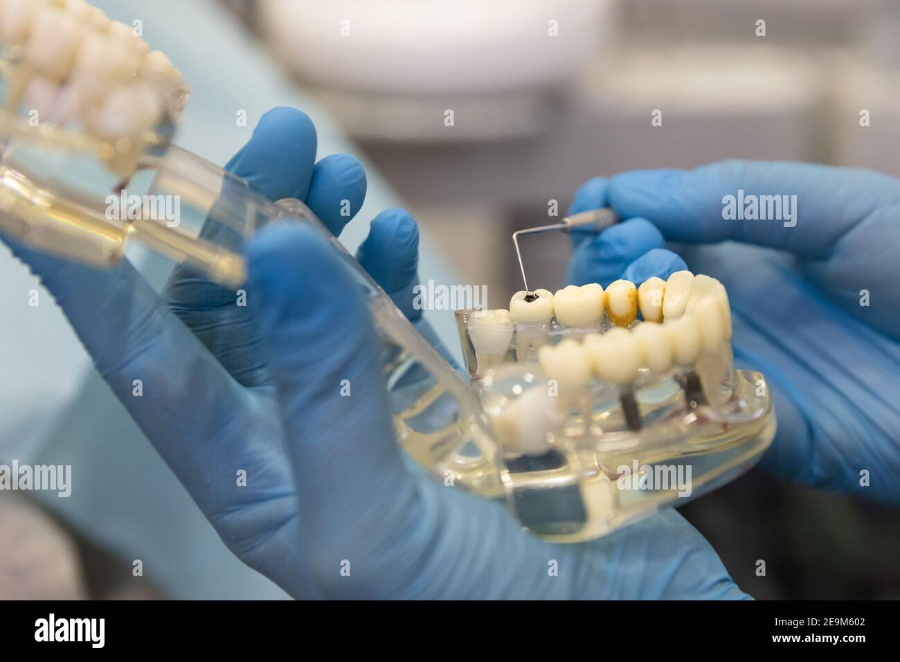 Closeup of dentist holding teeth model denture, showing what pulpitis ...