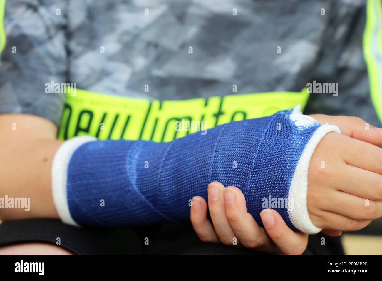 Close up of a boy with plaster arm (model released Stock Photo - Alamy