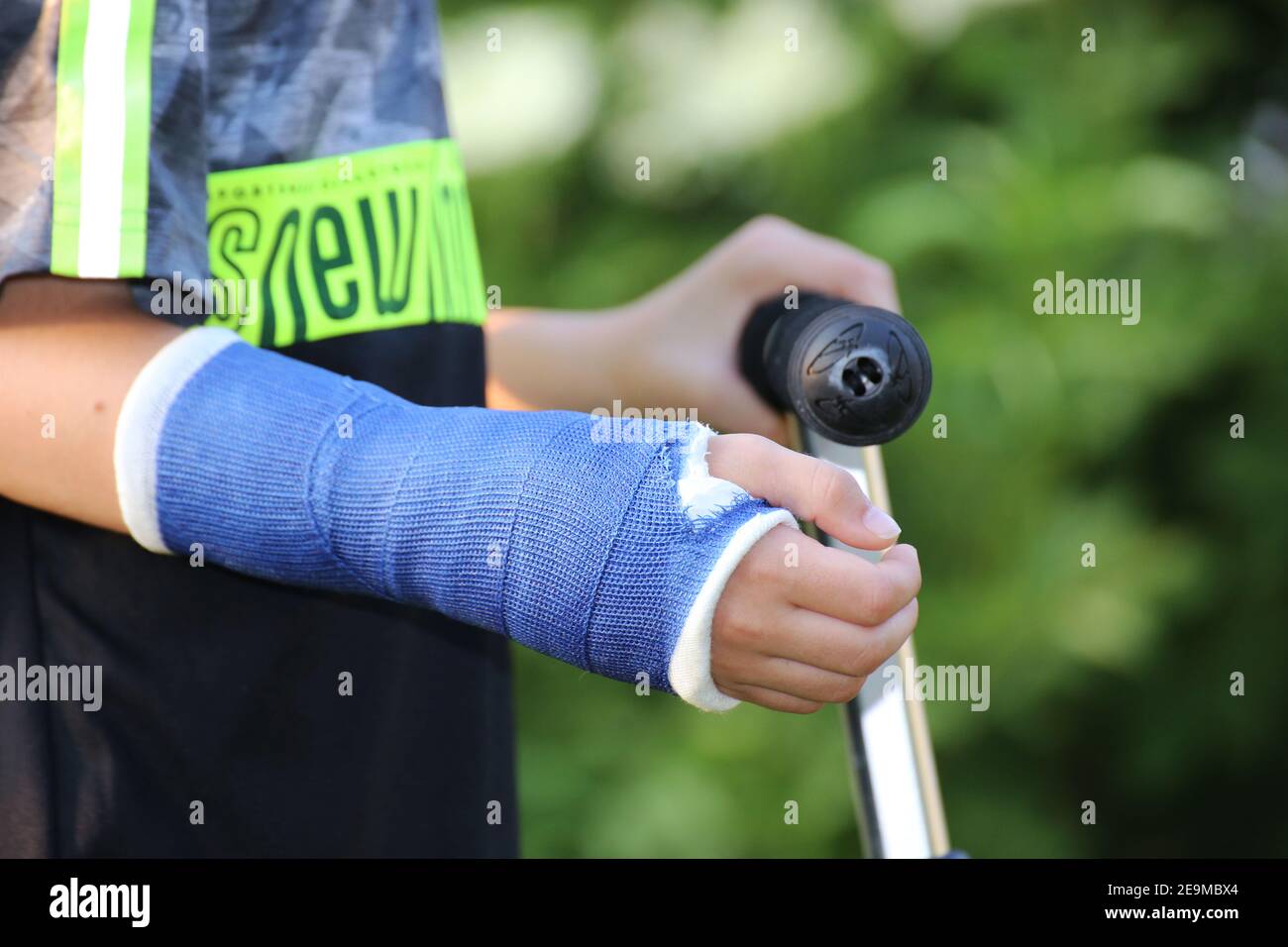 Close up of a boy with plaster arm (model released Stock Photo - Alamy