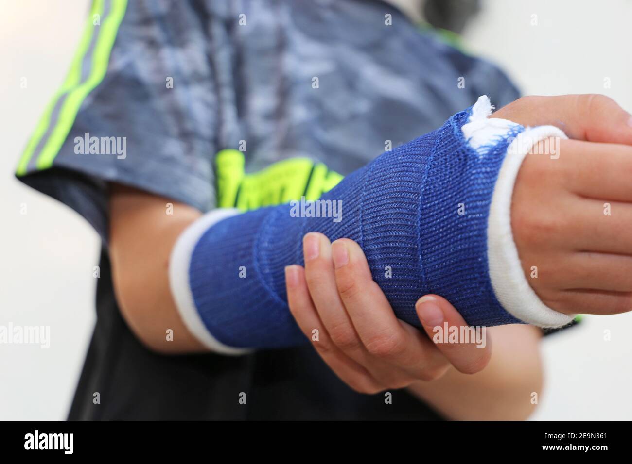 Close up of a boy with plaster arm (model released Stock Photo - Alamy