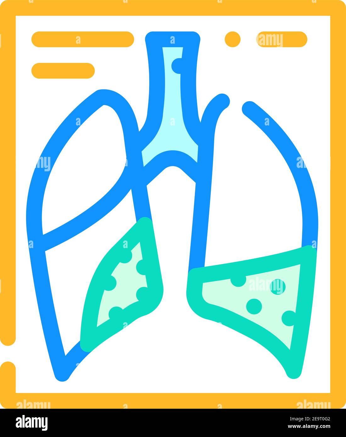 complications or pneumonia color icon vector illustration Stock Vector ...