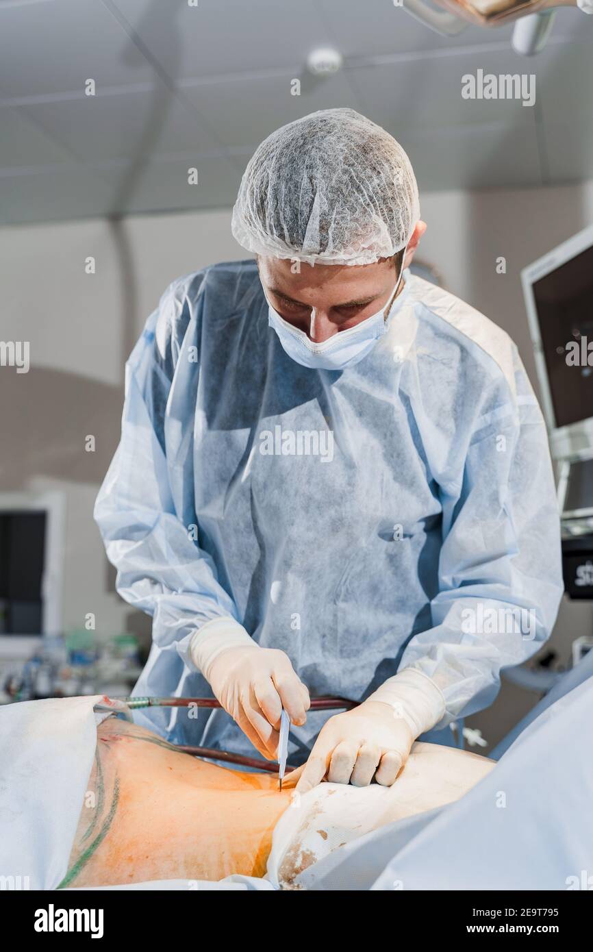 Surgeon removes fat in the gluteal region. Abdominoplasty - plastic ...