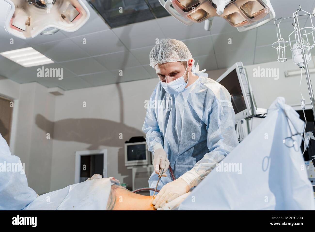 Surgeon removes fat in the gluteal region. Abdominoplasty - plastic ...