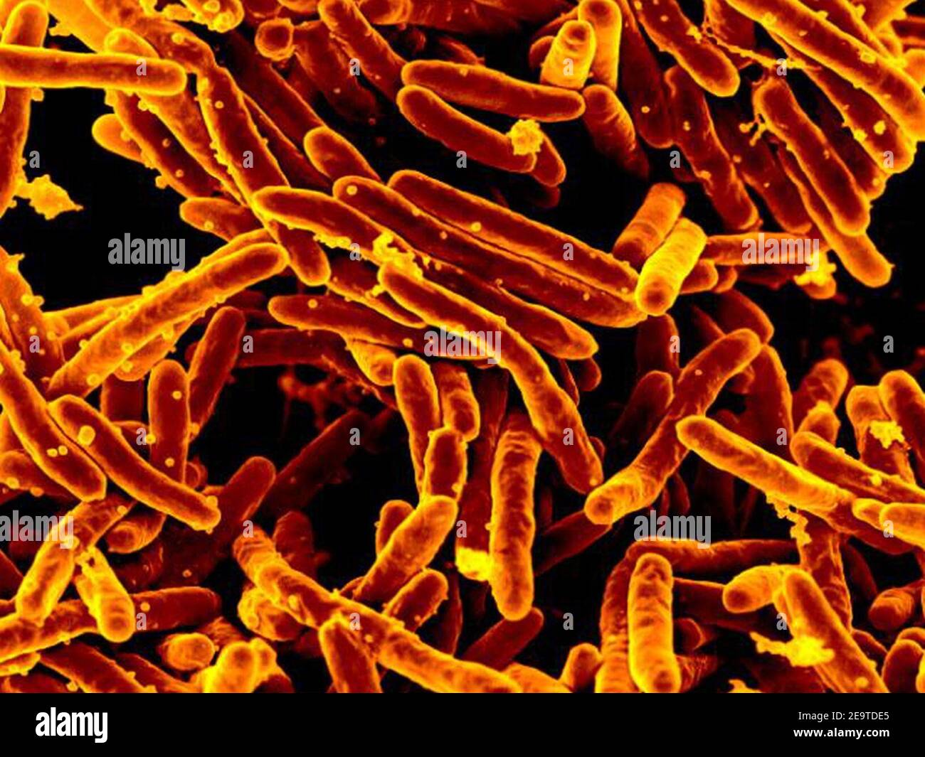 Mycobacterium tuberculosis MEB (1 Stock Photo - Alamy
