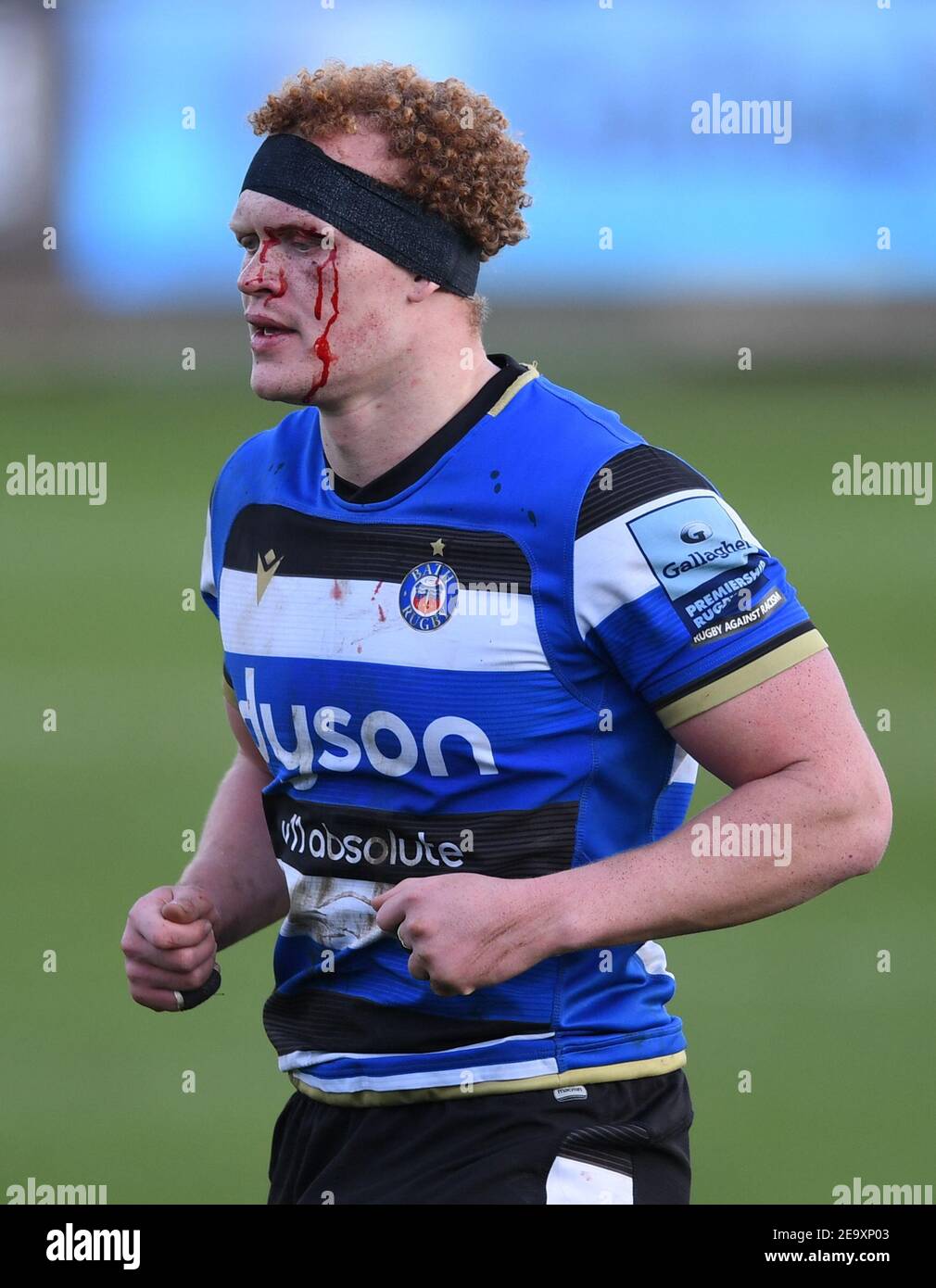 Head injury rugby hi-res stock photography and images - Alamy