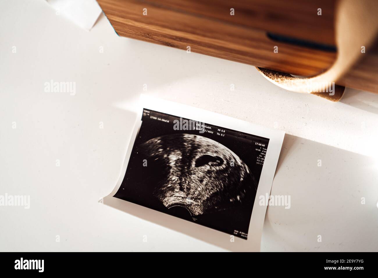 photo of an echo of an unborn baby Stock Photo - Alamy