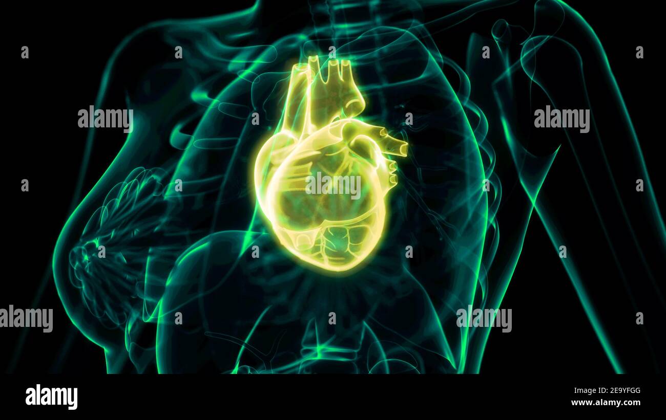 Angina x ray hi-res stock photography and images - Alamy