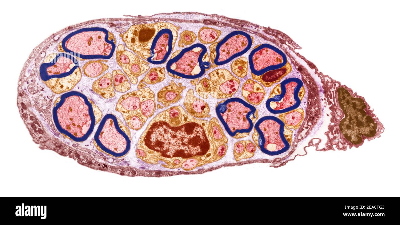 Peripheral nerve, TEM Stock Photo - Alamy