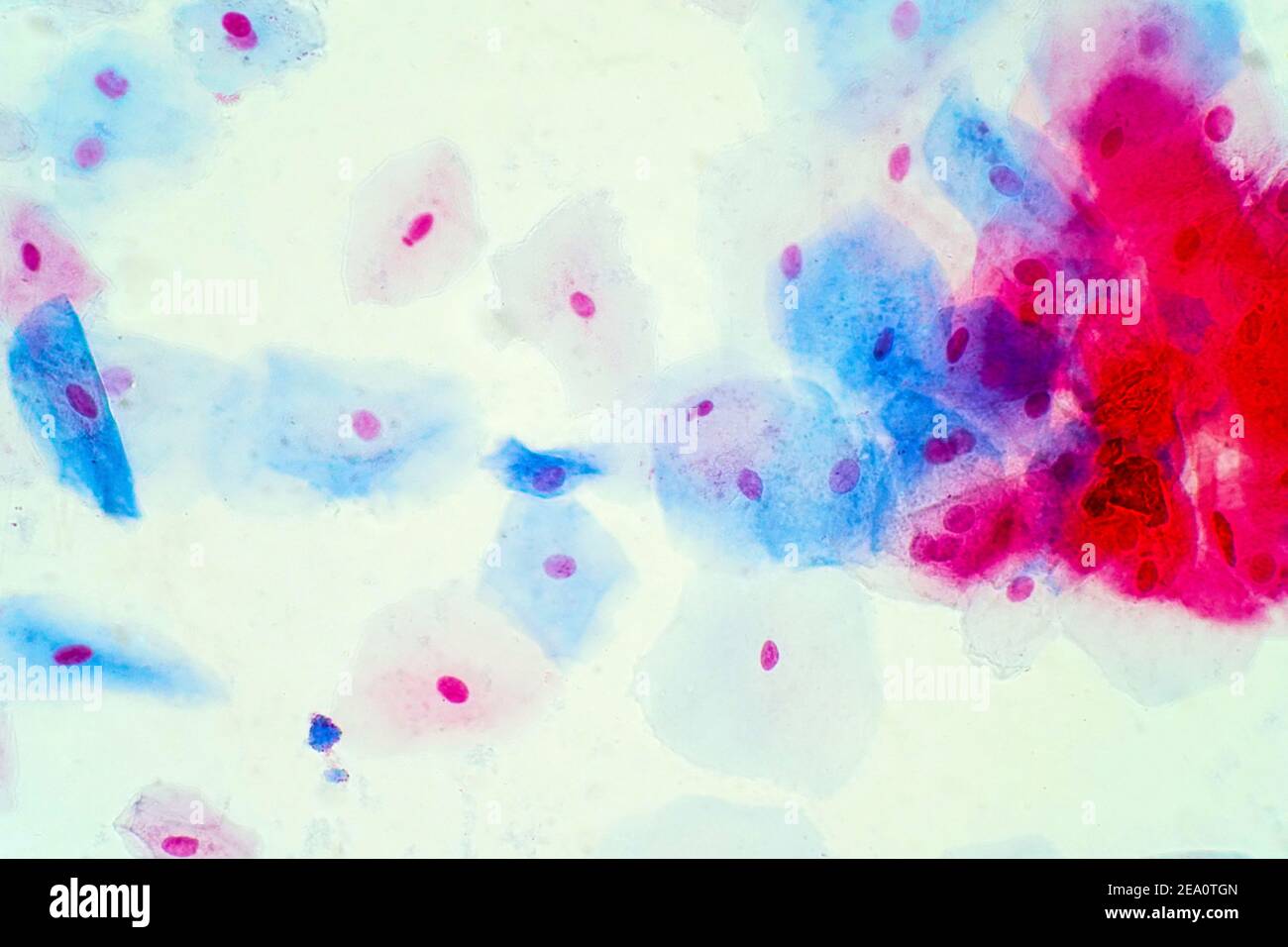 Epithelial cells micrograph hi-res stock photography and images - Alamy