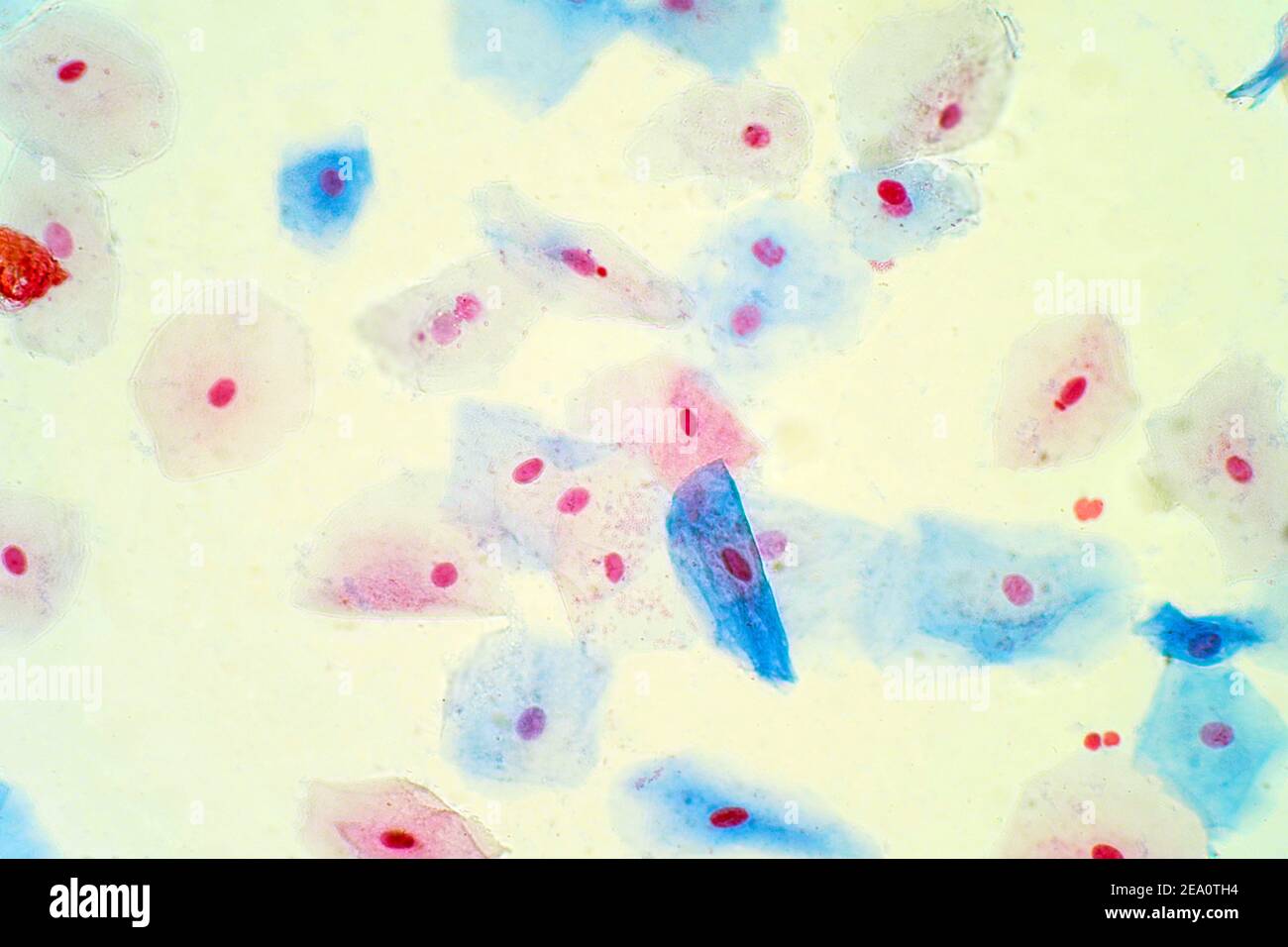 Epithelial cells micrograph hi-res stock photography and images - Alamy