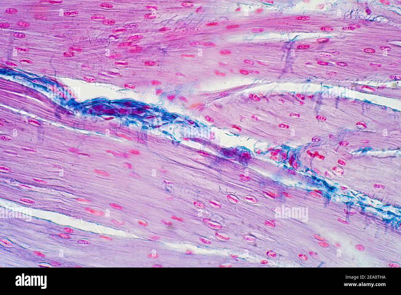 Muscle fiber micrograph hi-res stock photography and images - Alamy