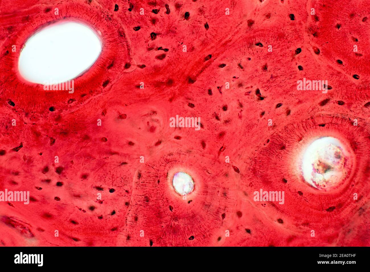 Human compact bone, light micrograph Stock Photo - Alamy