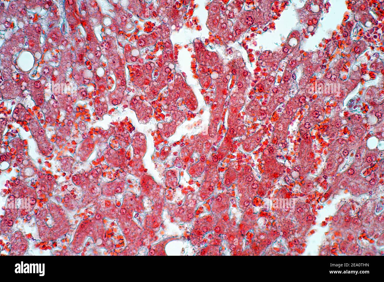 Liver cell hi-res stock photography and images - Alamy