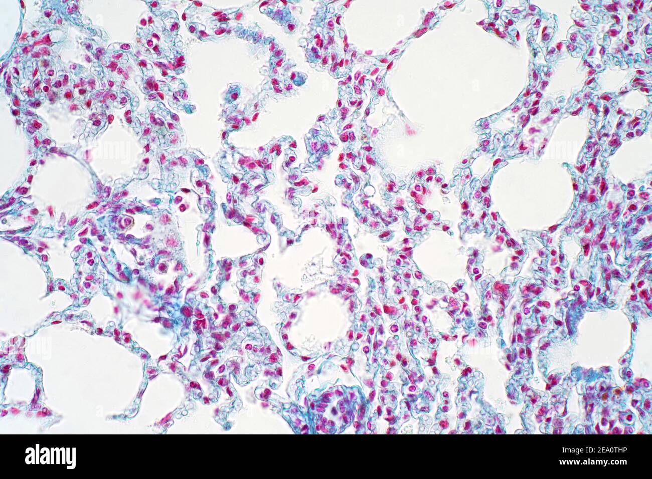 Human lungs anatomy and histology hi-res stock photography and images ...