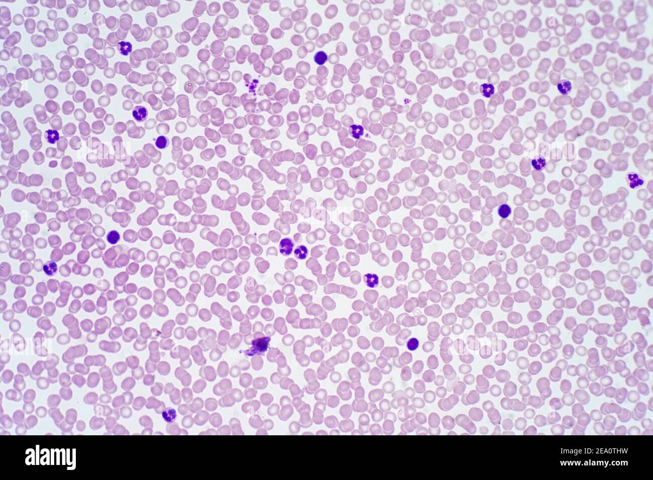 Blood cells, light micrograph Stock Photo - Alamy