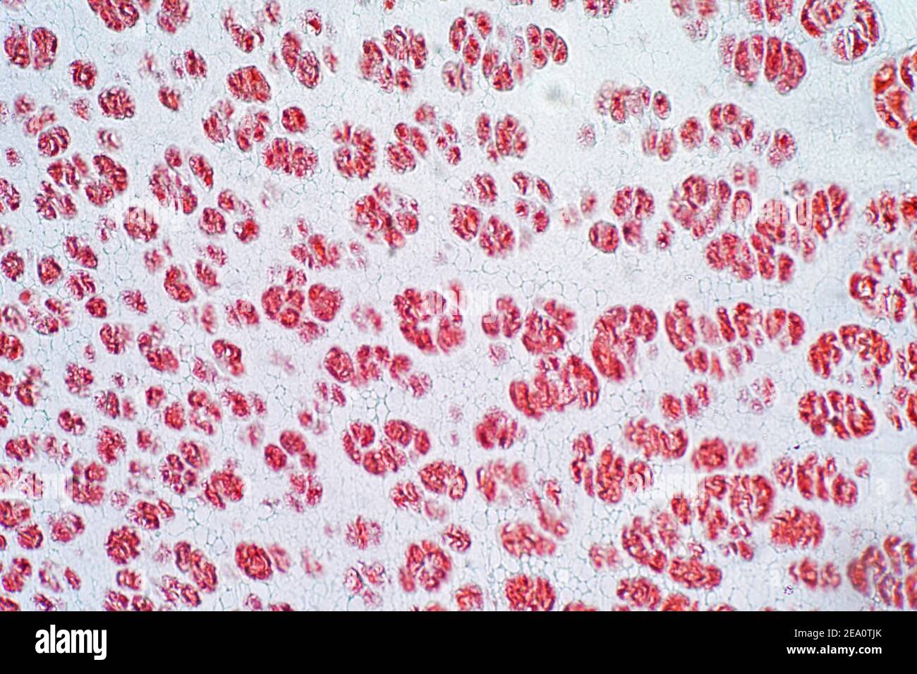 Human and cartilage bone, light micrograph Stock Photo - Alamy