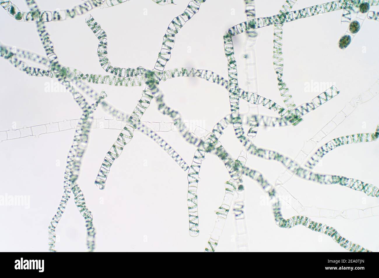 Spirogyra algae, light micrograph Stock Photo - Alamy Spirogyra algae, light micrograph Stock Photo - Alamy