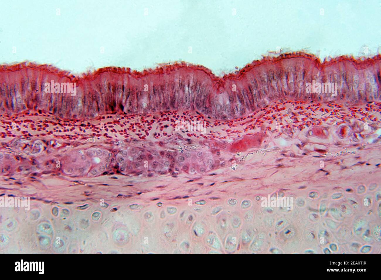 Epithelium micrograph hi-res stock photography and images - Alamy