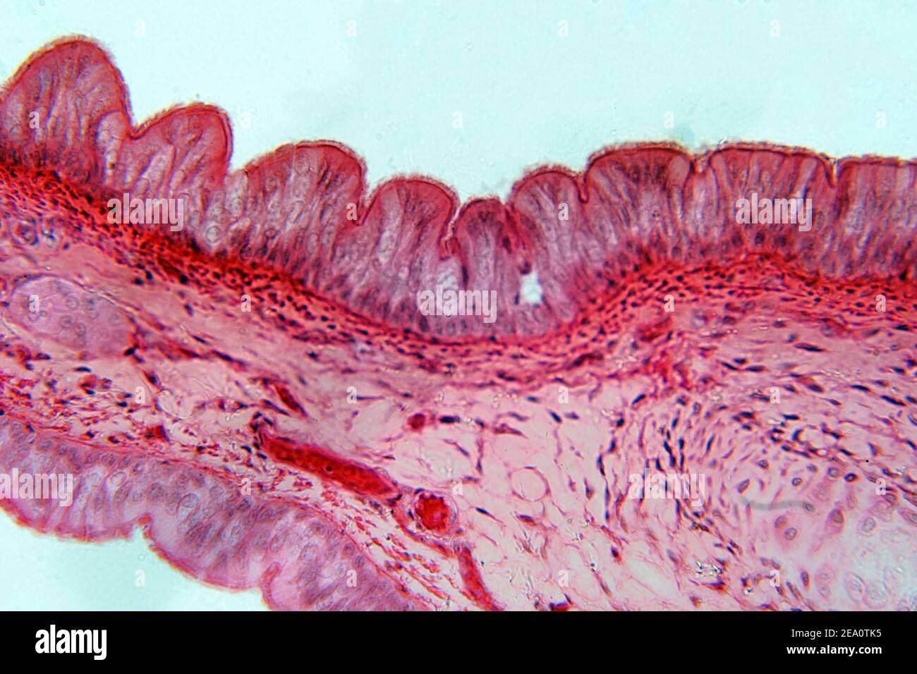 Epithelium micrograph hi-res stock photography and images - Alamy