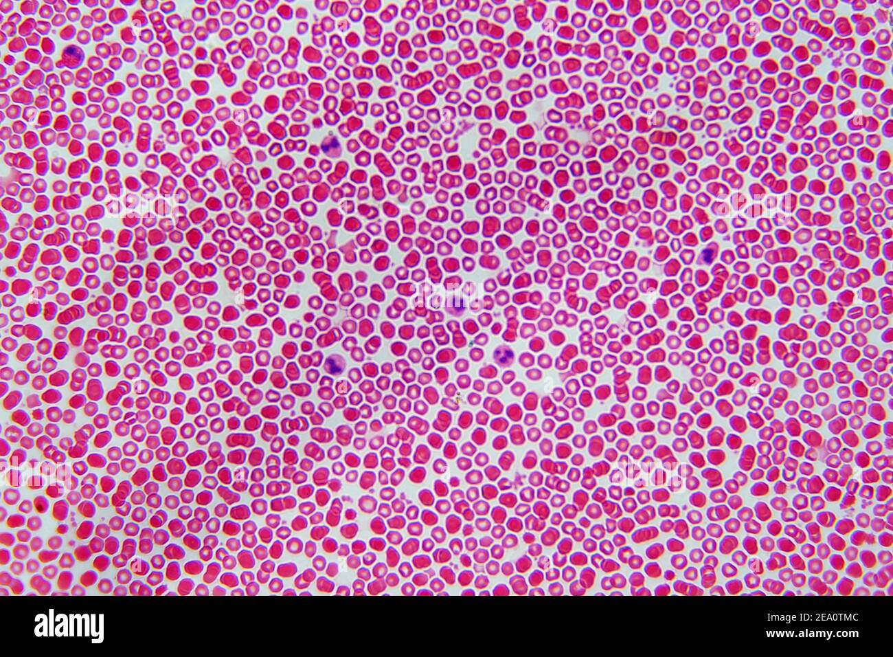 Human blood smear light micrograph hi-res stock photography and images ...