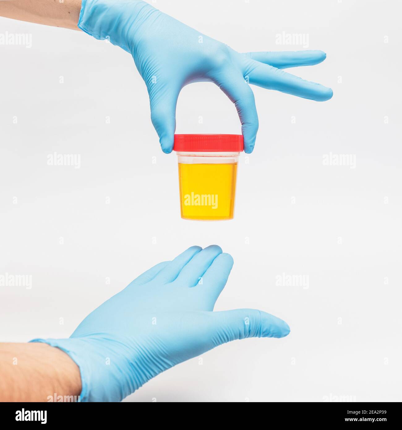 urine sample analysis in a jar in hands gloves by a doctor or a bio lab ...