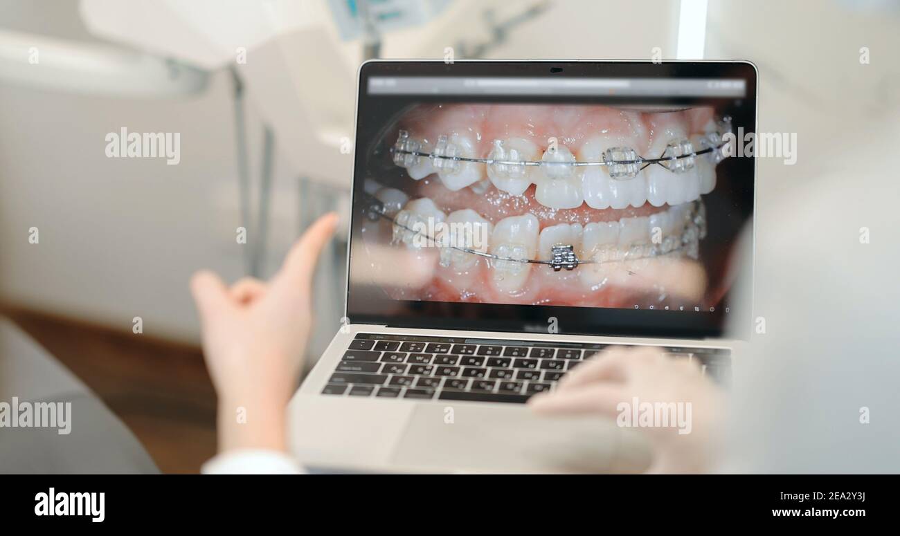 Dentist showing photo of teeth on a laptop for a young patient Stock ...