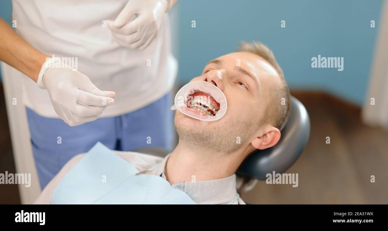 Orthodontic visit hi-res stock photography and images - Alamy